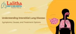 Understanding Interstitial Lung Disease: Symptoms & Treatments